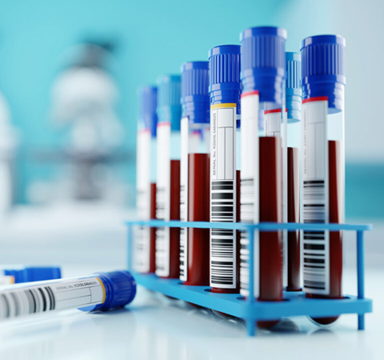 Prélèvement DPNI - Lkolmc